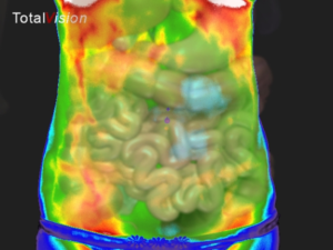 Is Your Liver Emotional? – Thermography Medical Clinic